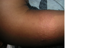 Little Fire Ant - Kauai Invasive Species Committee (KISC)